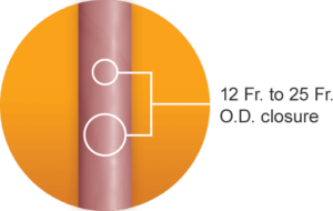 MANTA® Vascular Closure Device