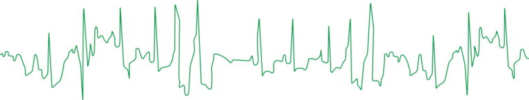 The AC3 Optimus™ Intra-Aortic Balloon Pump