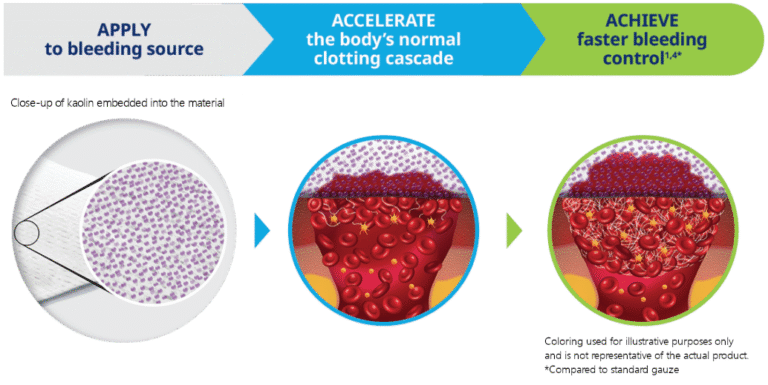 QuikClot™ Hemostatic Dressings - Teleflex Interventional
